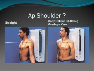 Ppshoulder | PPT