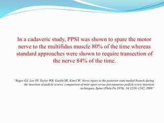 Percutaneous Pedicle Screw Fixation For Thoracolumbar injuries using a ...
