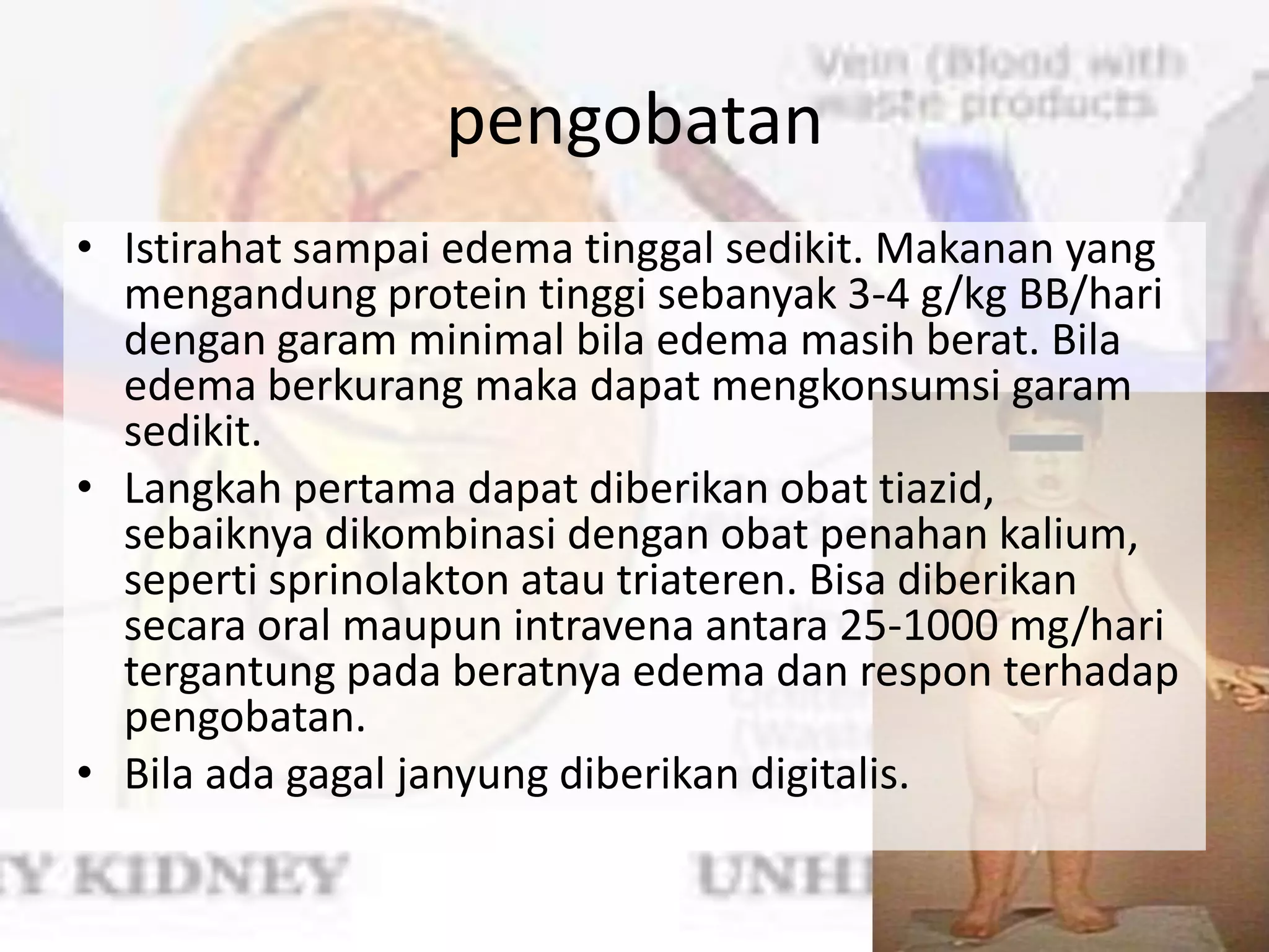 Ppt sindrom nefrotik | PPTX