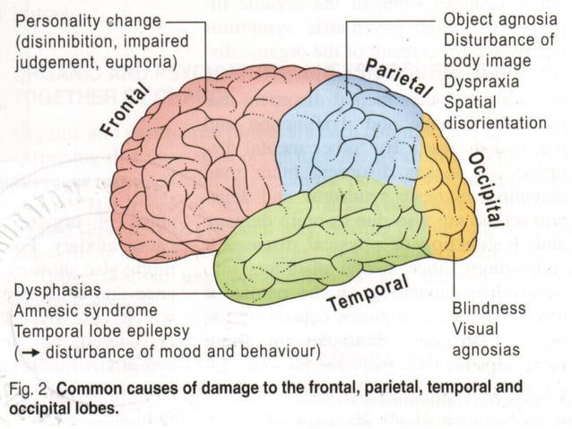 Organic Brain Syndromes | PPT | Sleep Disorders | Diseases and Conditions