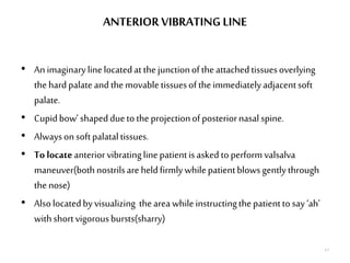 Vibrating Line Of Palate