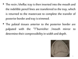 posterior palatal seal | PPTX