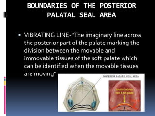 PPS PROSTHODONTICS | PPTX