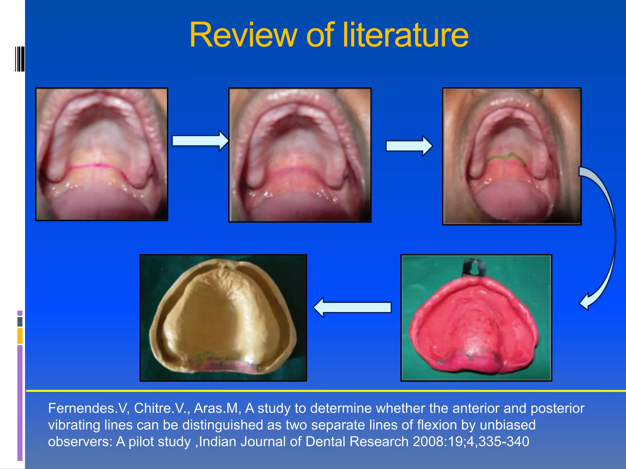 posterior palatal seal ppt | PPTX