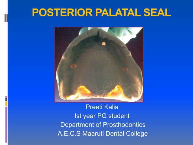 posterior palatal seal ppt | PPTX