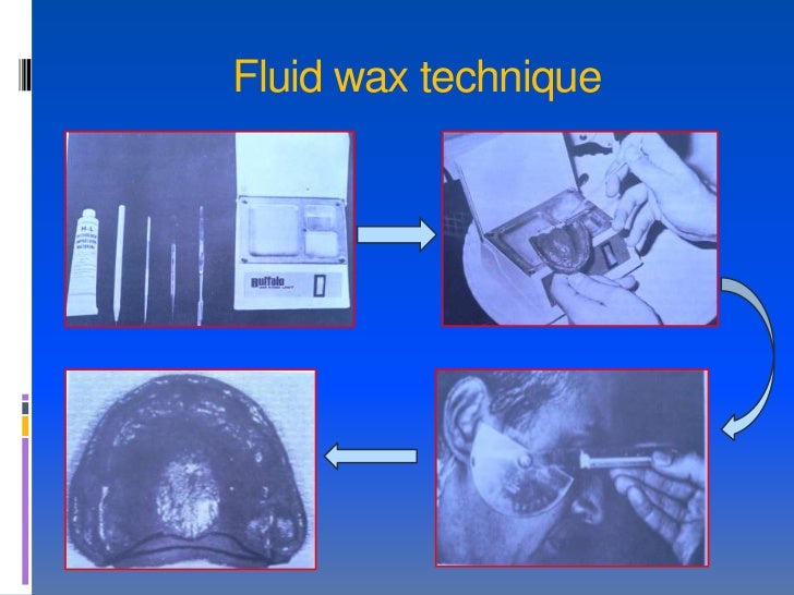 posterior palatal seal ppt