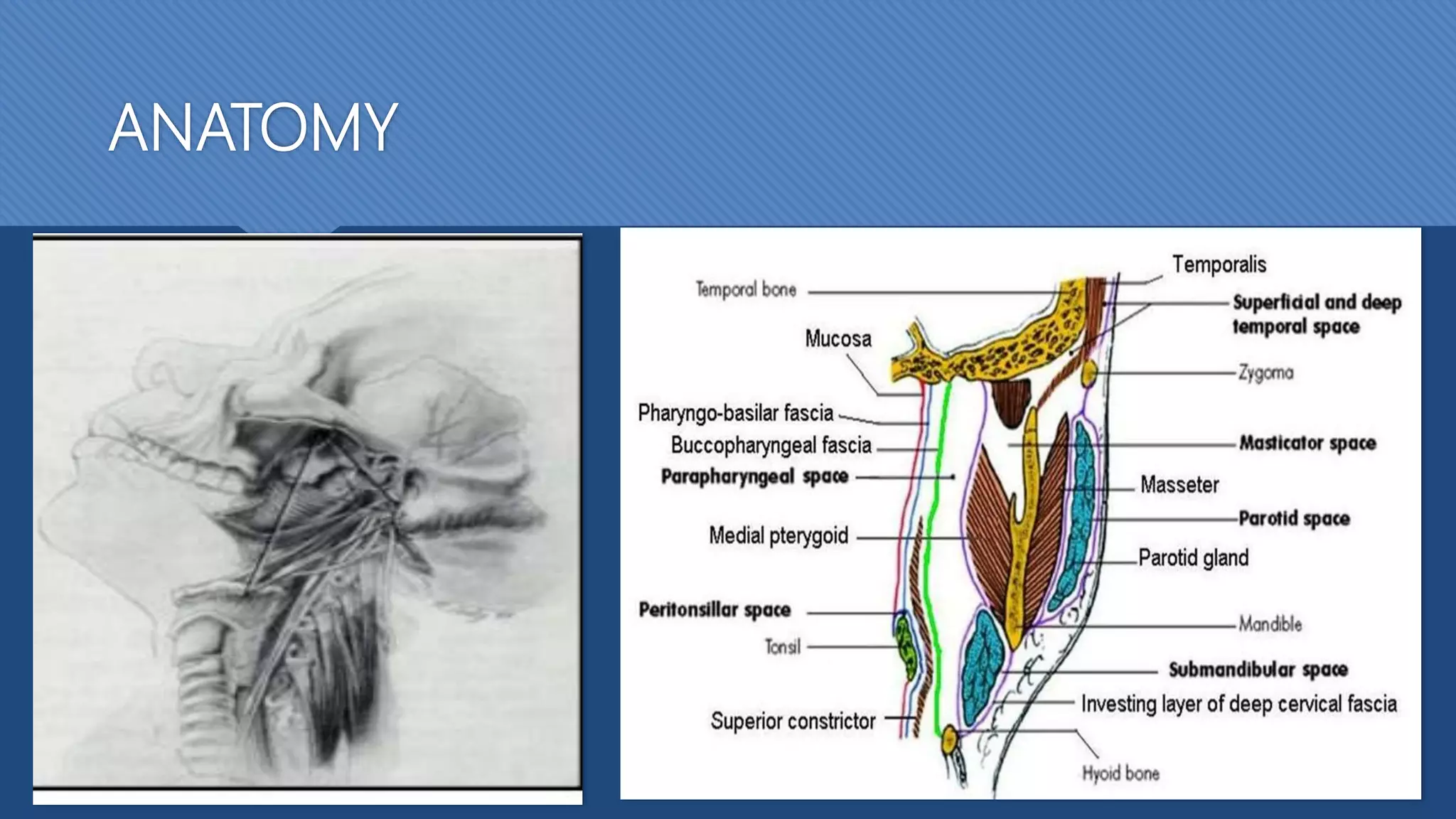 parapharyngeal space tumors | PPTX