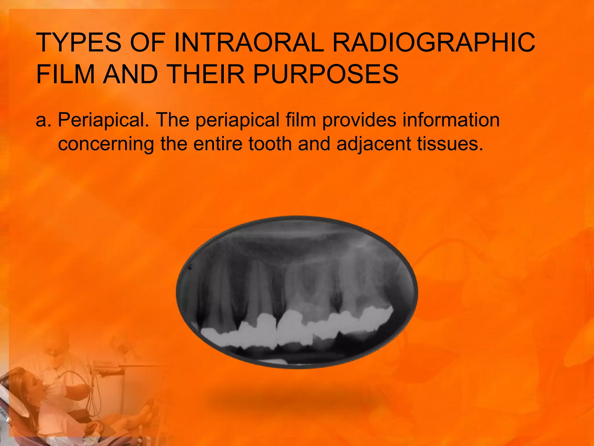 INTRAORAL RADIOGRAPHY | PPTX