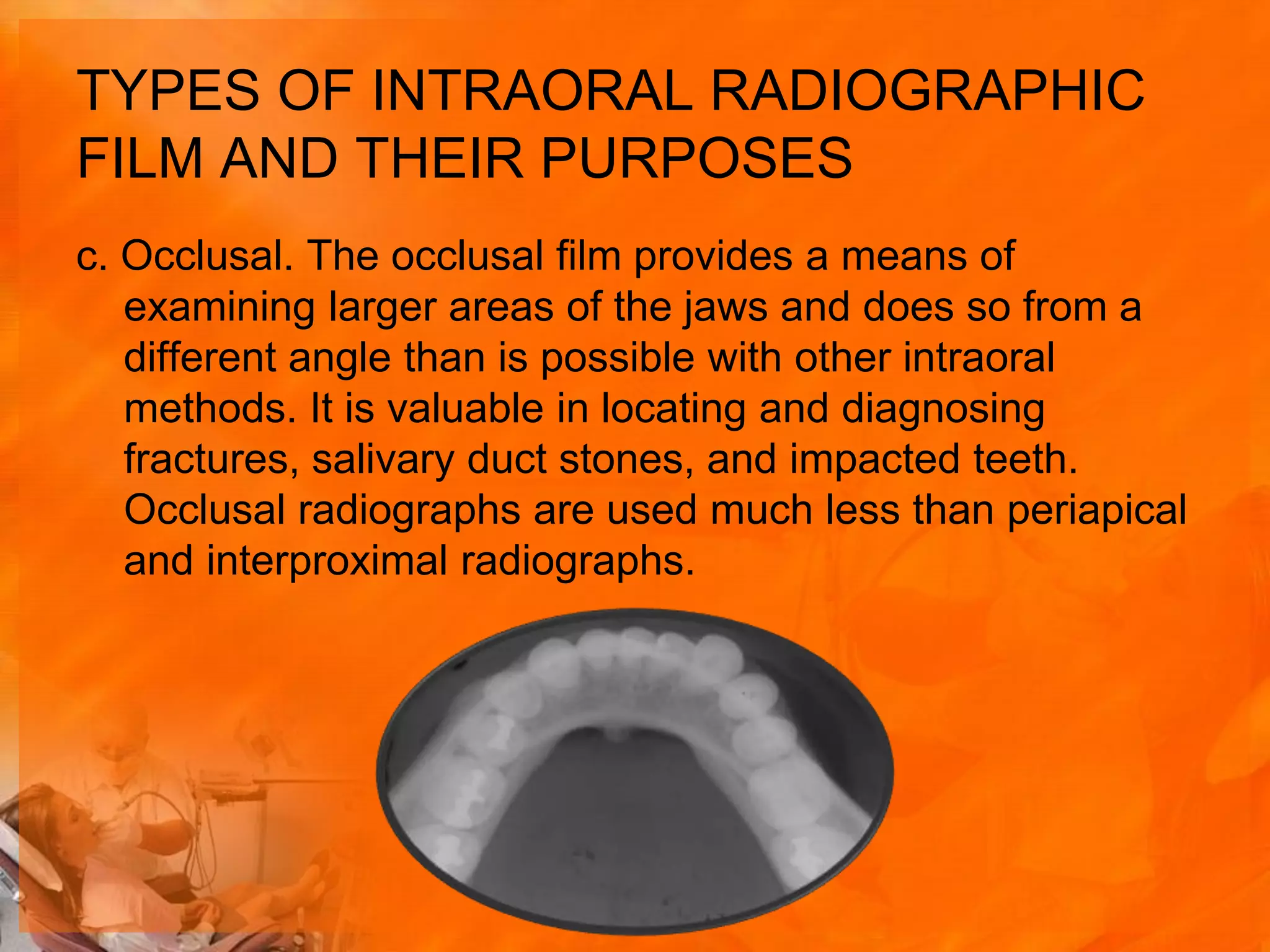 INTRAORAL RADIOGRAPHY | PPTX