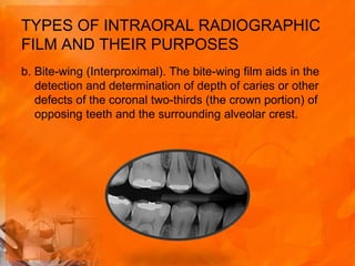 INTRAORAL RADIOGRAPHY | PPTX