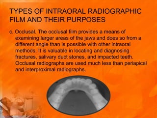 INTRAORAL RADIOGRAPHY | PPTX