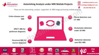 MRI Image Processing Matlab Projects Research Assistance | PPT