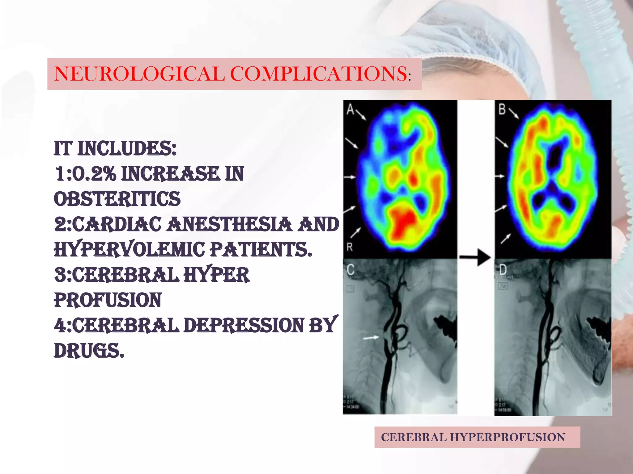 GENERAL ANESTHESIA AND ITS COMPLICATIONS | PPTX