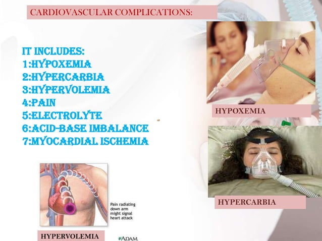GENERAL ANESTHESIA AND ITS COMPLICATIONS | PPTX