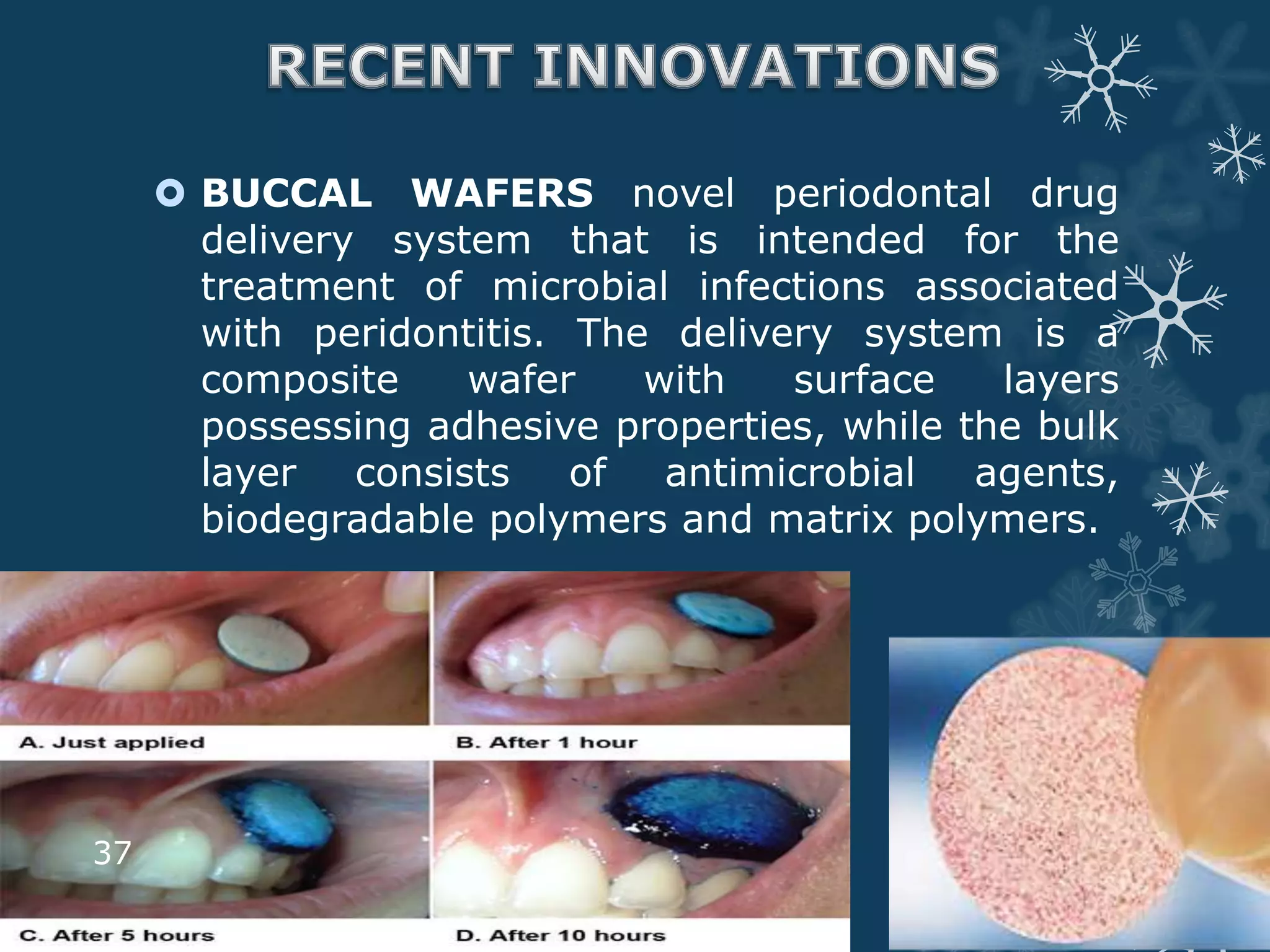 Buccal &Sublingual Drug Delivery System | PPTX