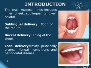 Buccal &Sublingual Drug Delivery System | PPT