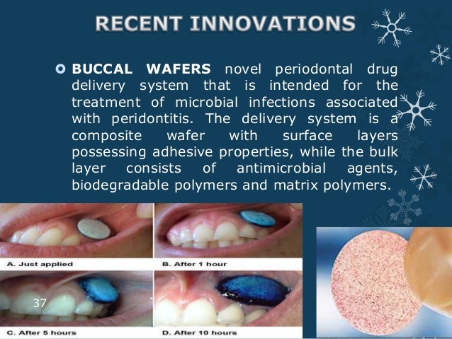 Buccal &Sublingual Drug Delivery System