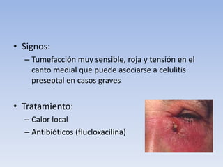 Patología de la vía lagrimal (oflalmo) | PPTX