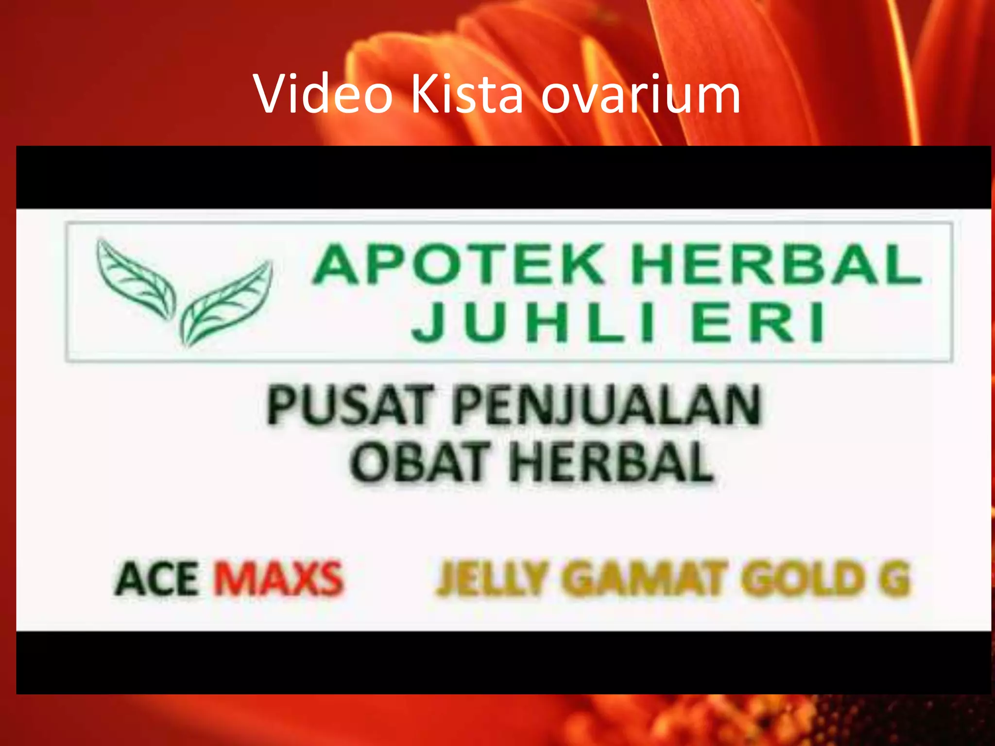 Kista Ovarium | PPTX