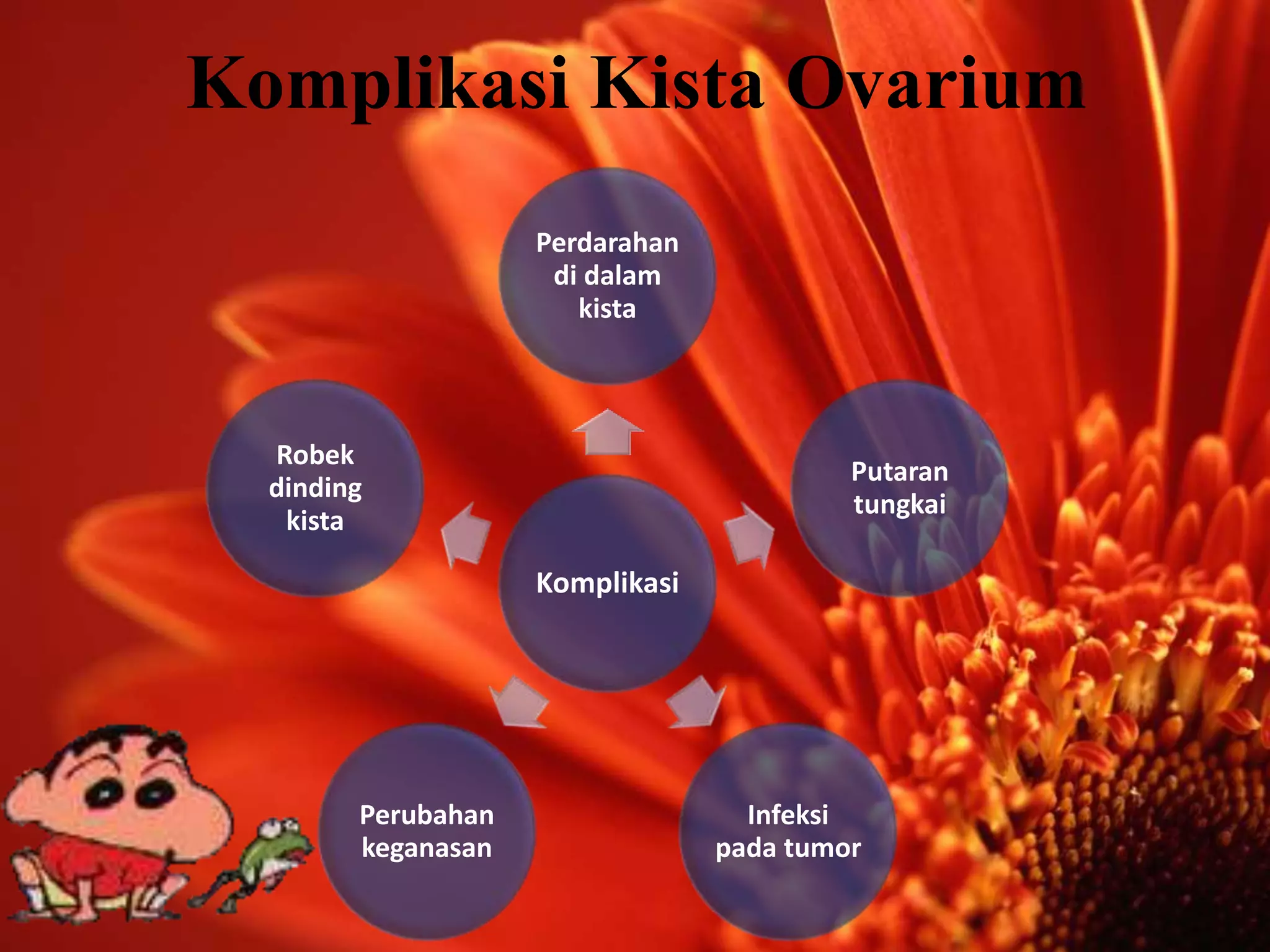 Kista Ovarium | PPTX