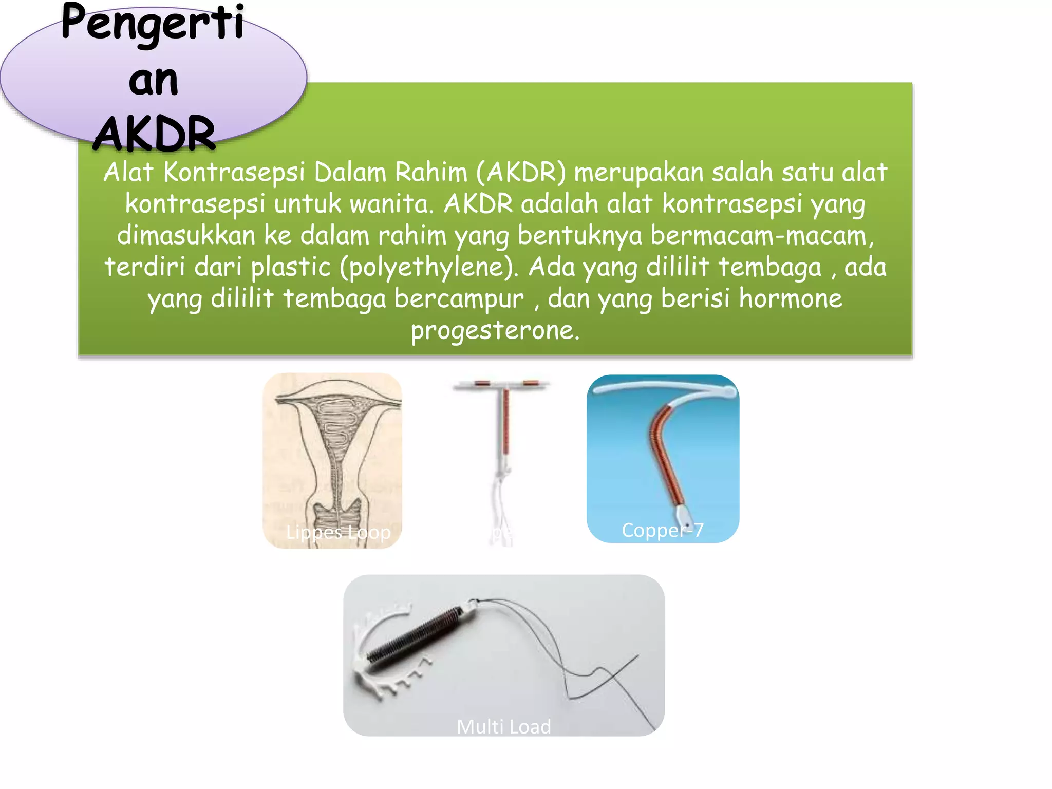Kontrasepsi IUD | PPTX