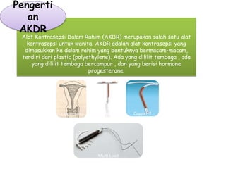 Kontrasepsi IUD | PPTX