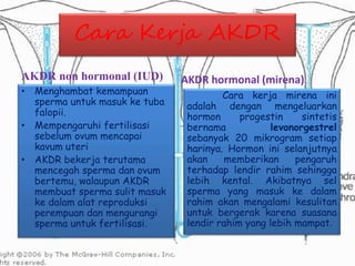 Kontrasepsi IUD | PPTX