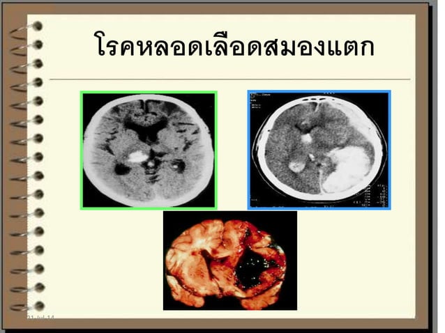 Ppt Stroke Pptx