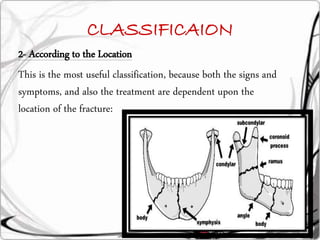 mandibular fracture | PPTX