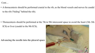 THORACENTESIS; SITE AND MATERIALS | PPTX