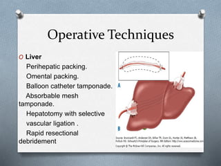 damage control surgery | PPTX