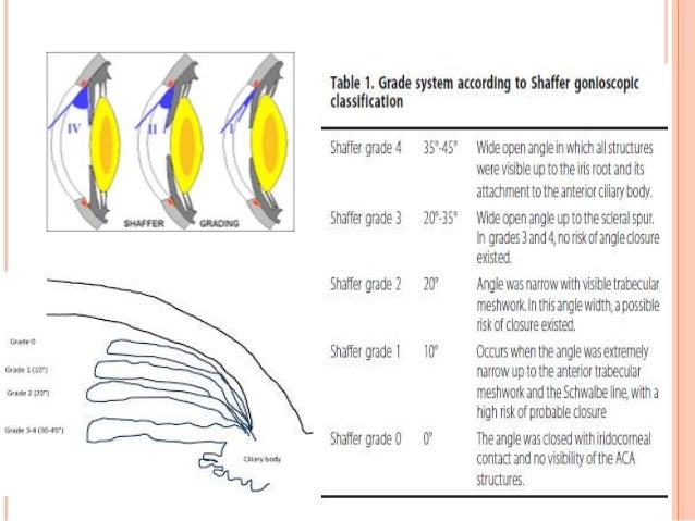 Anatomy of anterior chamber