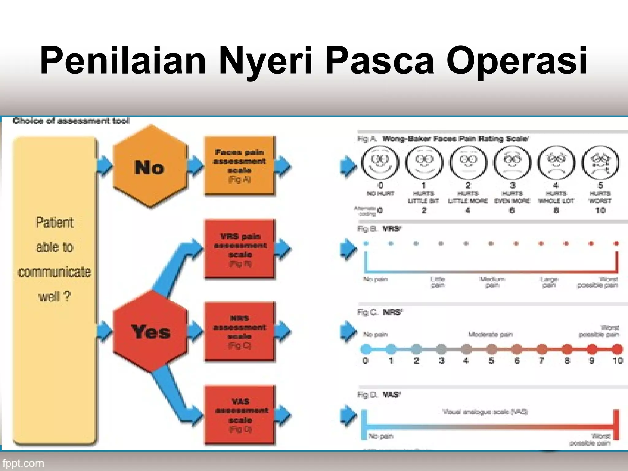Ppt.. tatalaksana nyeri pasien post op | PPT