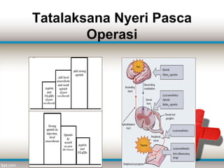 Ppt.. tatalaksana nyeri pasien post op | PPT