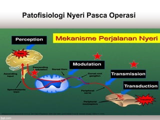 Ppt.. tatalaksana nyeri pasien post op | PPT