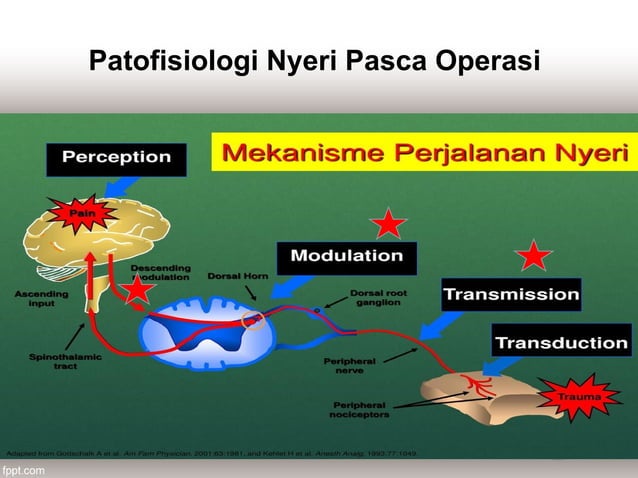 Ppt.. tatalaksana nyeri pasien post op | PPT