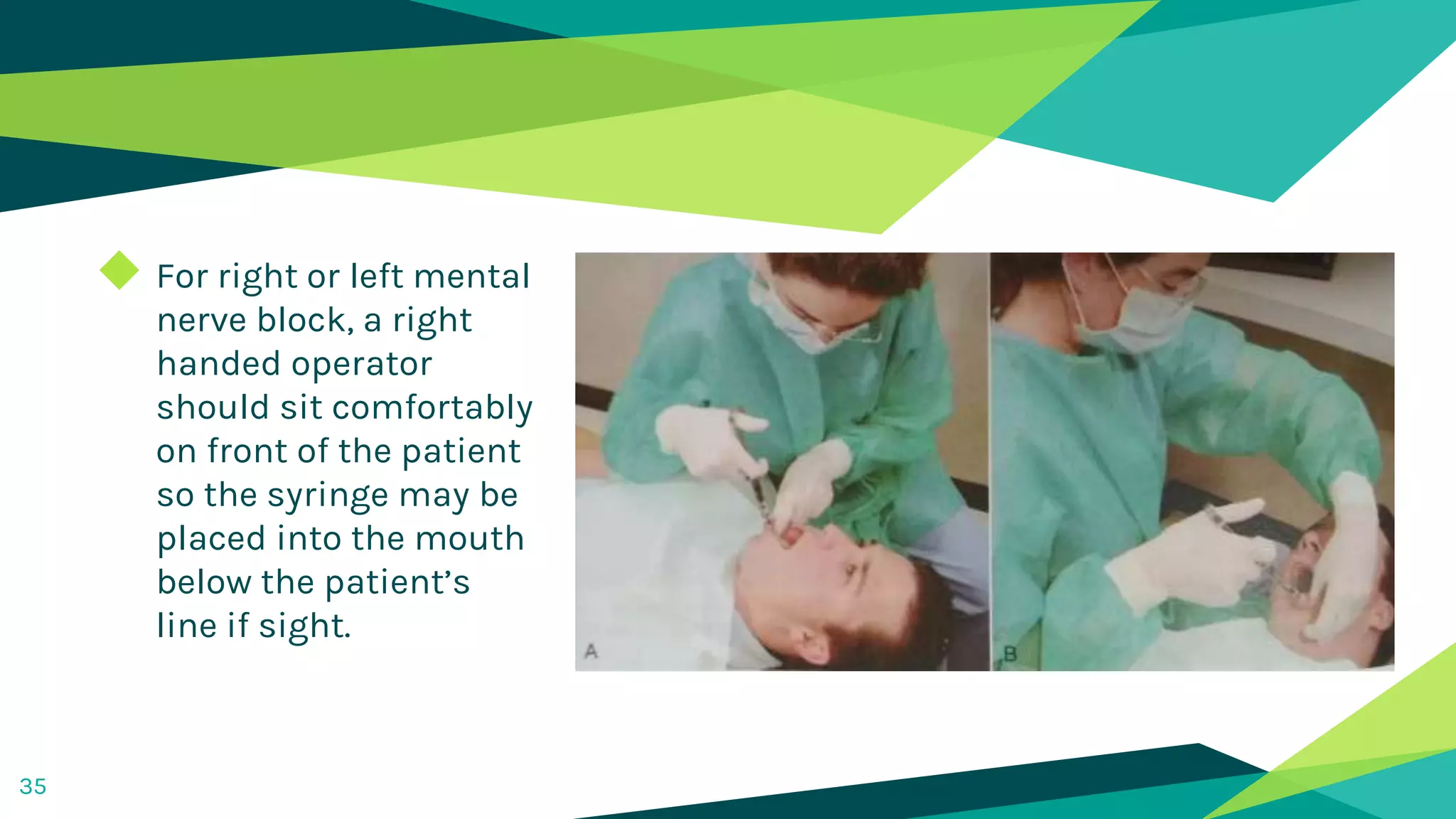 Local anesthesia in children | PPTX