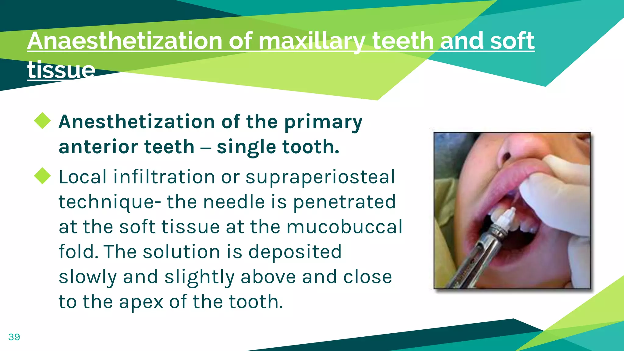 Local anesthesia in children | PPTX