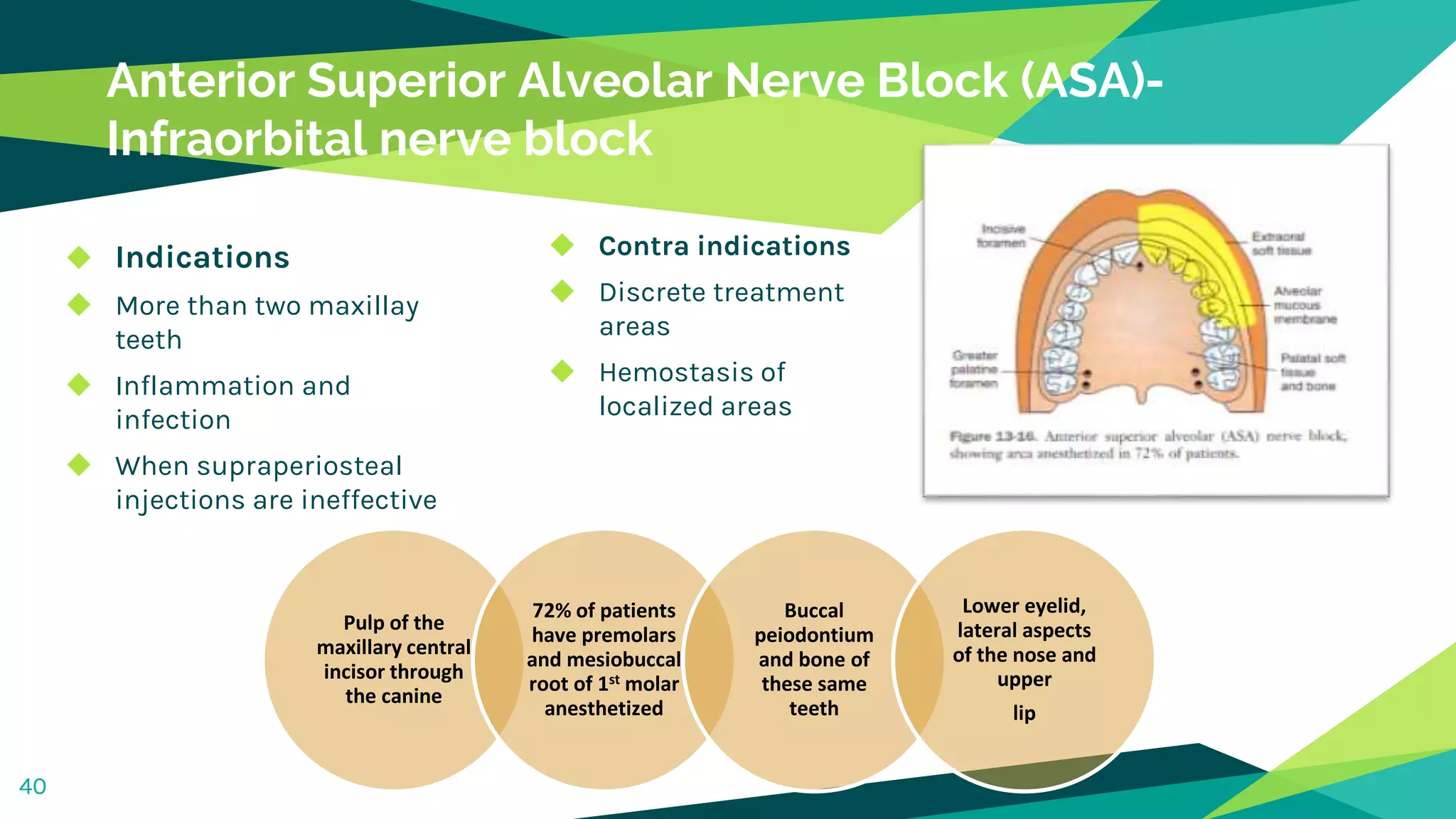 Local anesthesia in children | PPTX