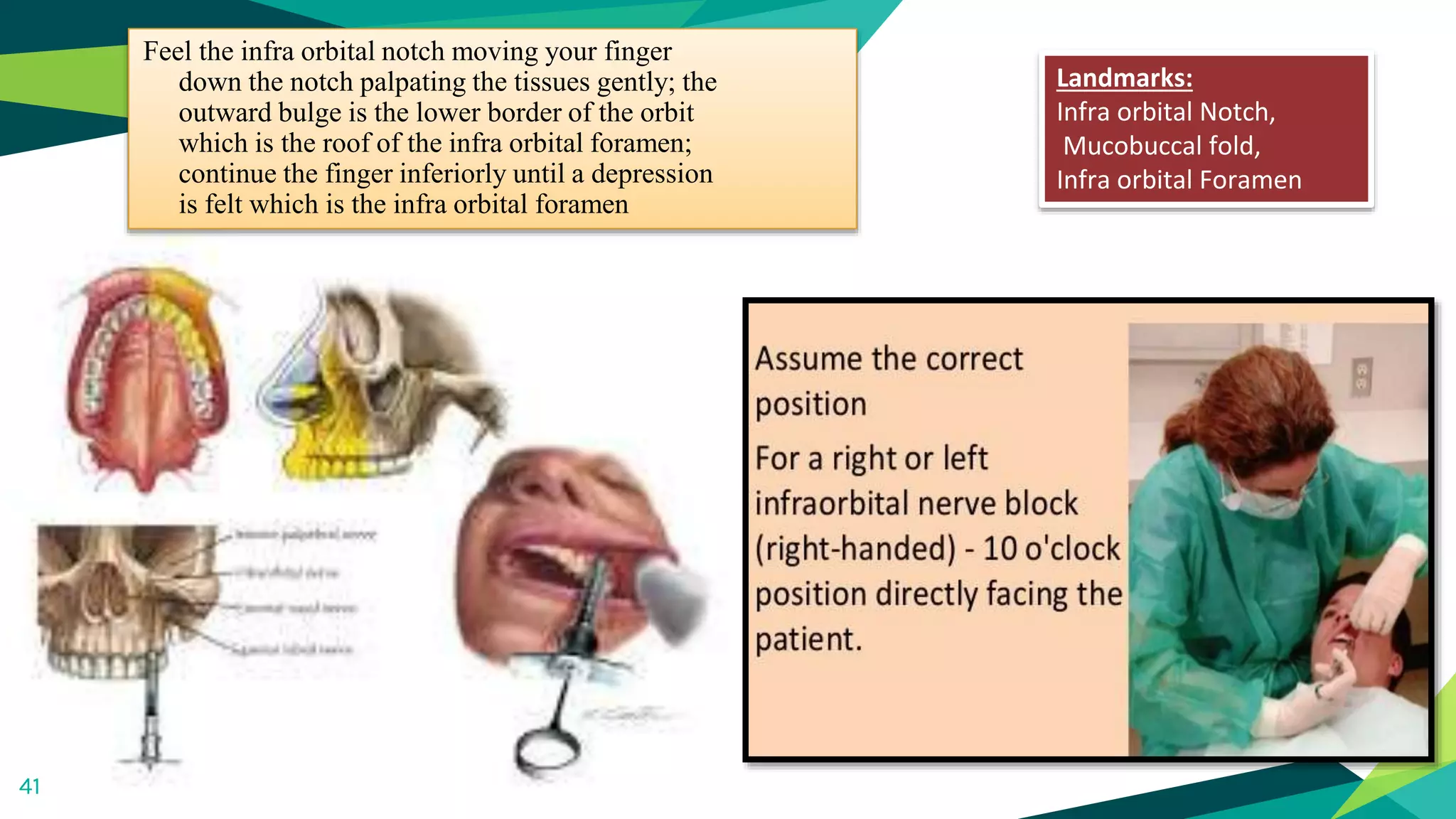 Local anesthesia in children | PPTX