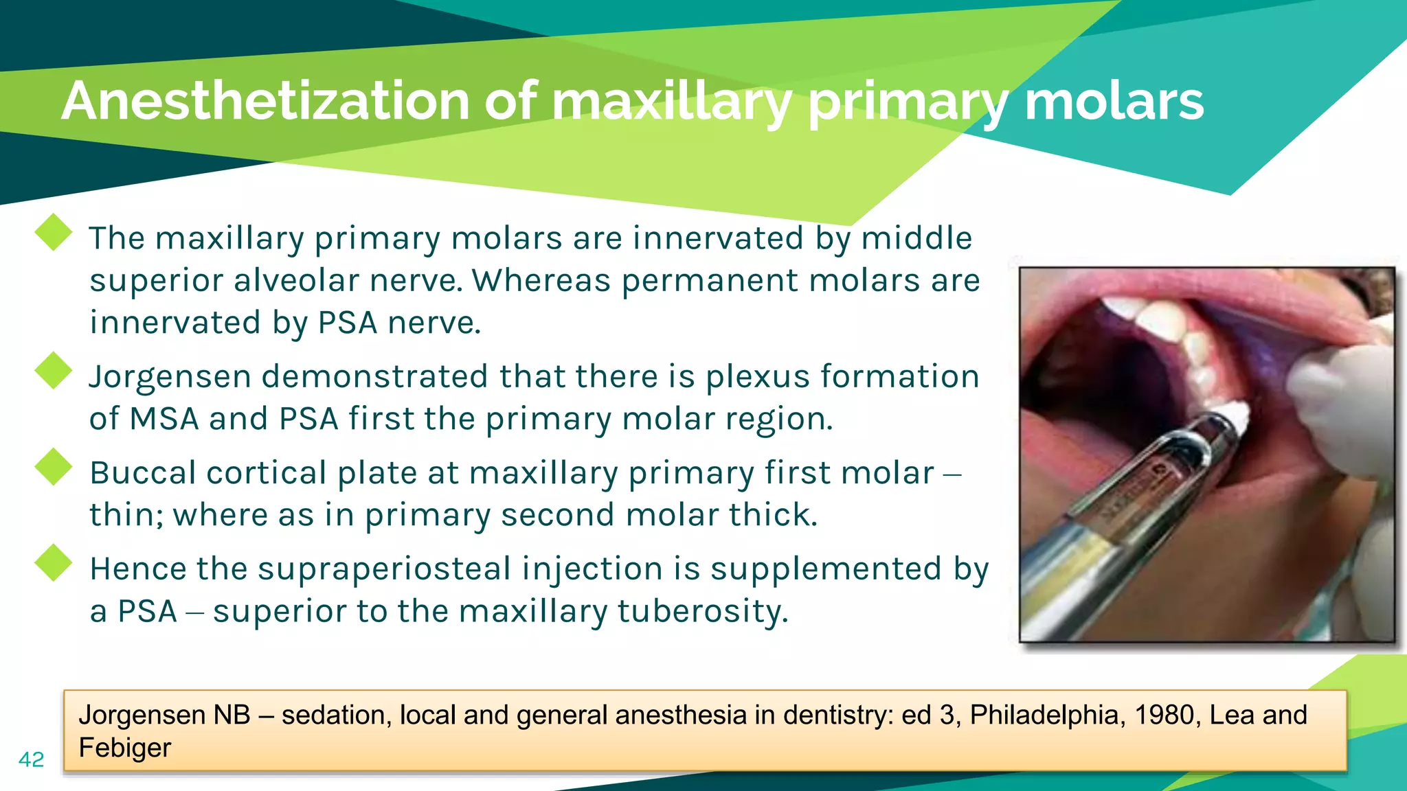 Local anesthesia in children | PPTX