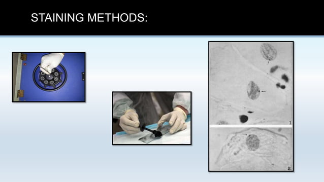 saliva in forensics | PPTX