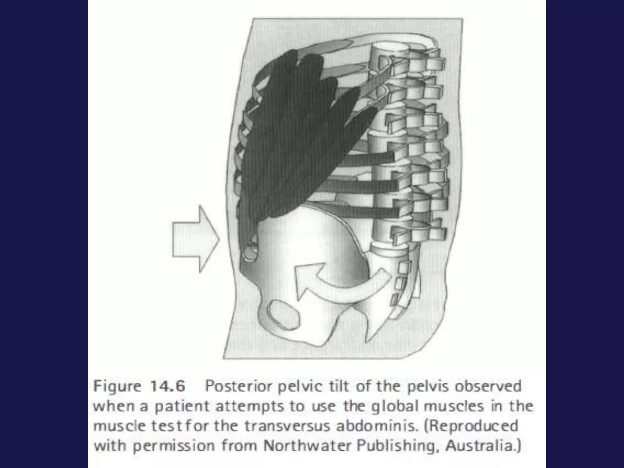 core muscle strengthening | PPTX