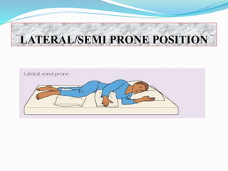 Semi Prone Position