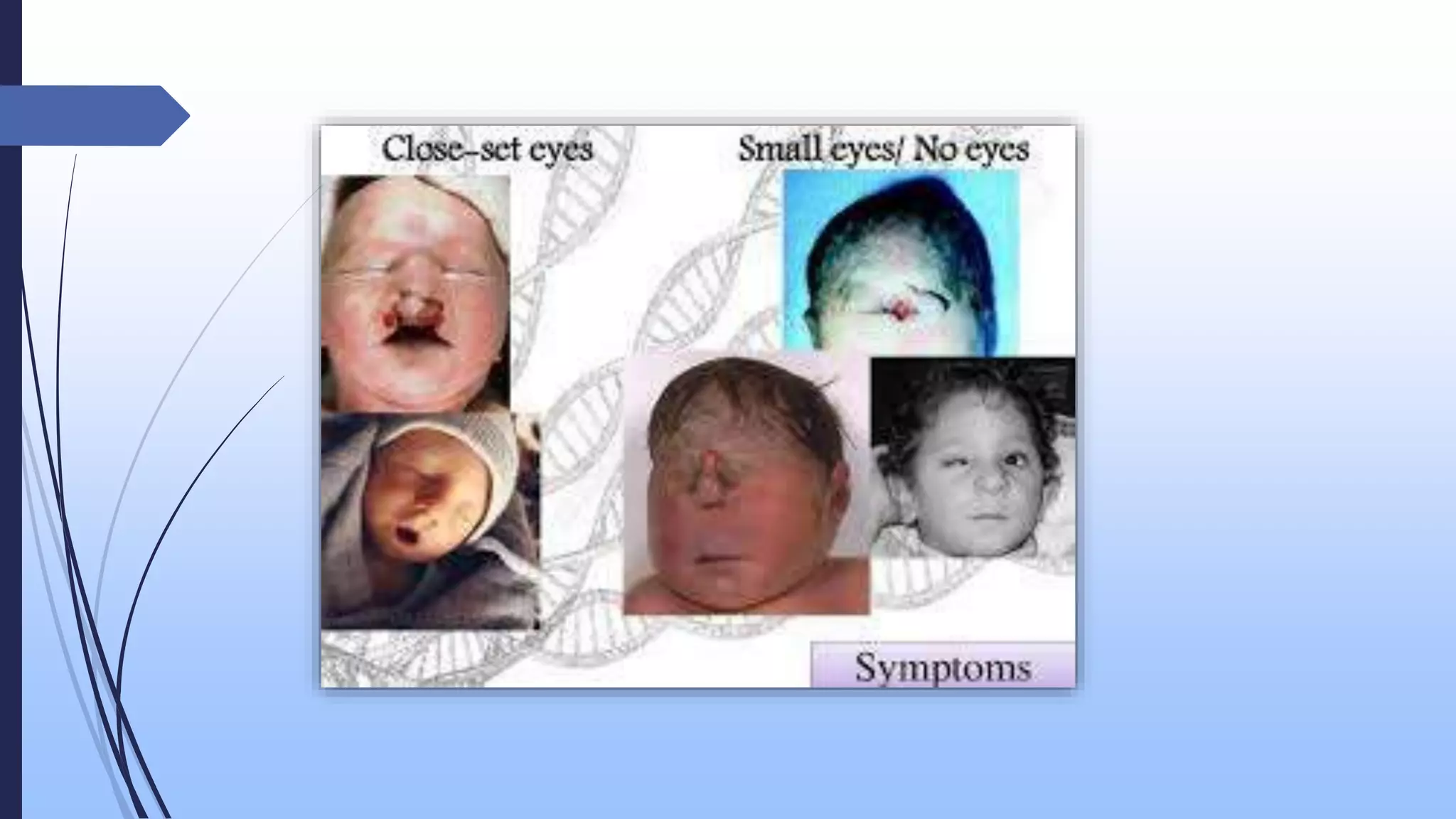 Human health and Chromosomal Disorders | PPT