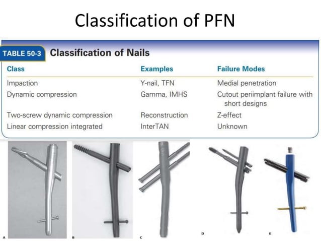 Tips, tricks and pitfalls of proximal femoral nailing (PFN)