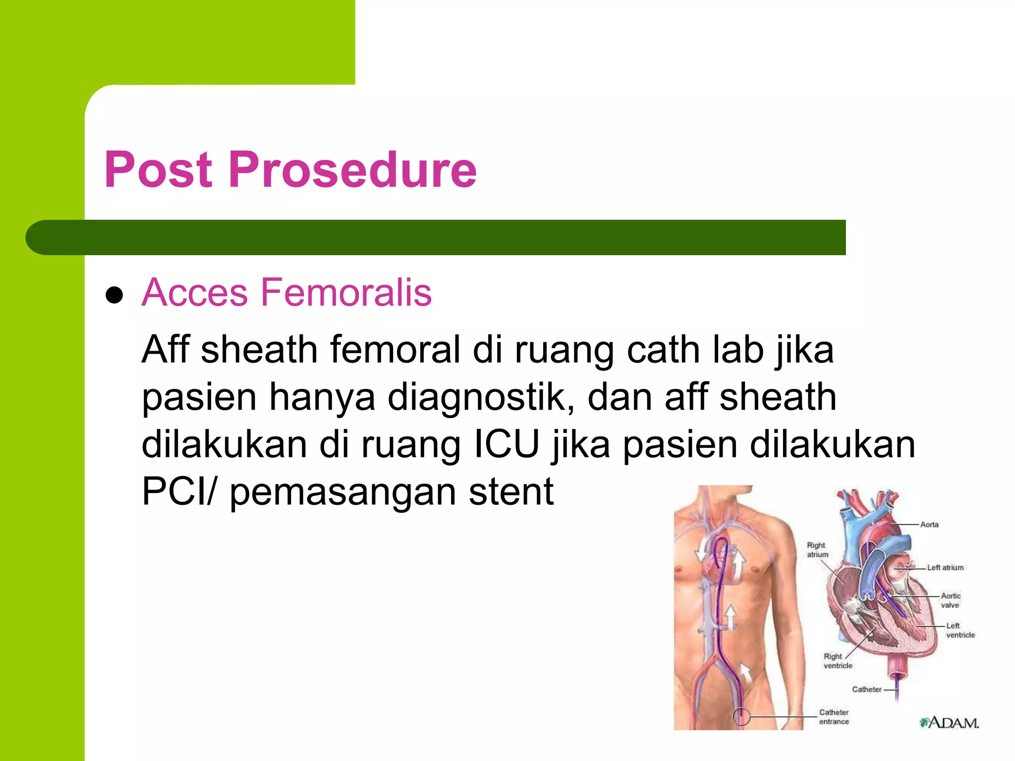 PPT. PTCA CATHLAB.ppt