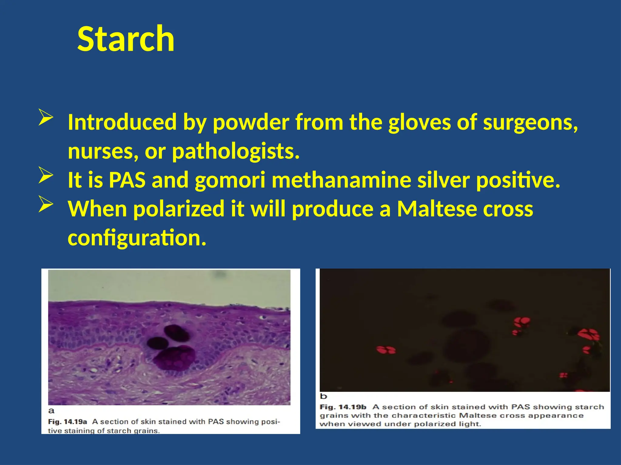 pigment and its stain in histopathology.pptx