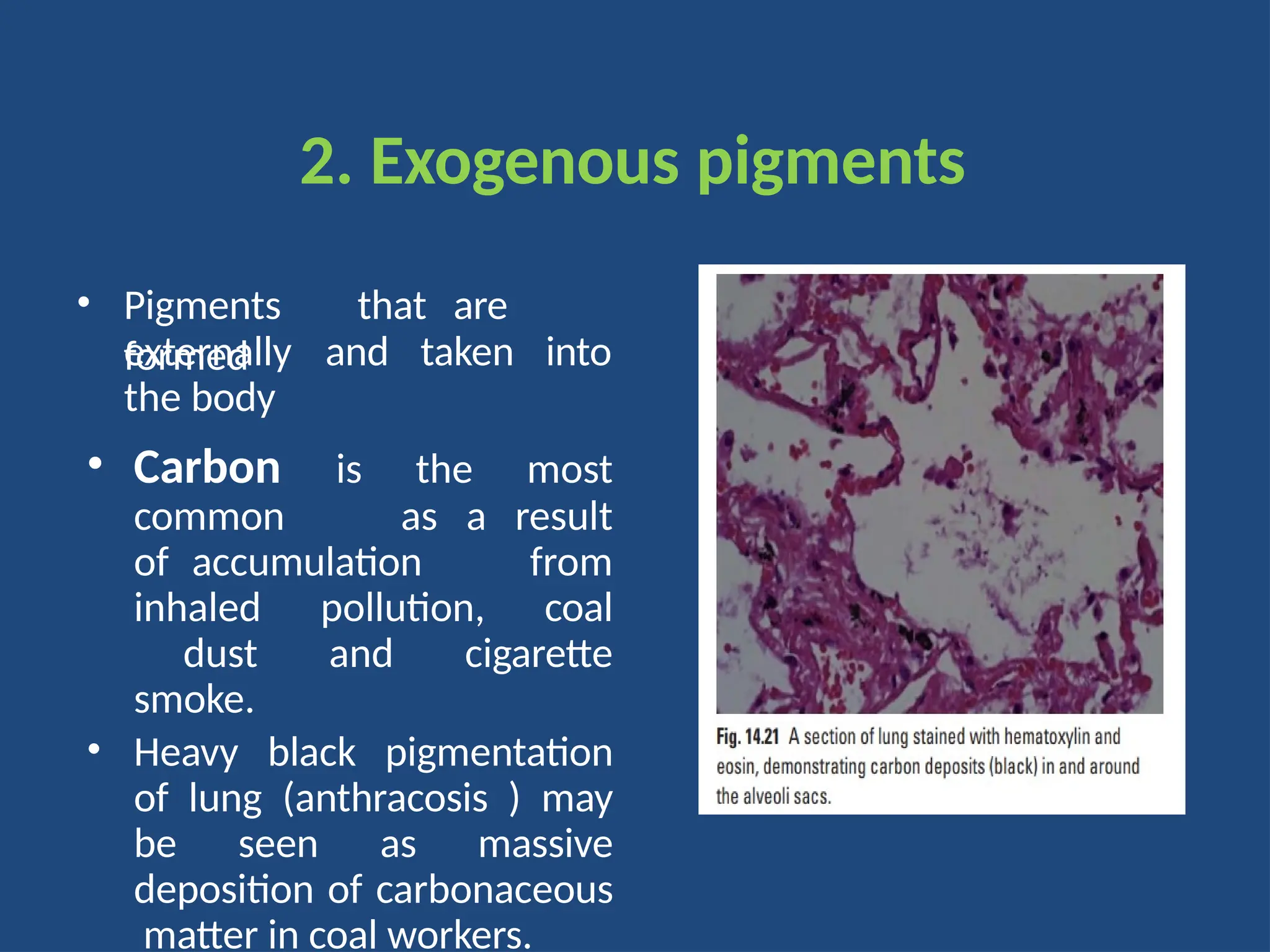 pigment and its stain in histopathology.pptx