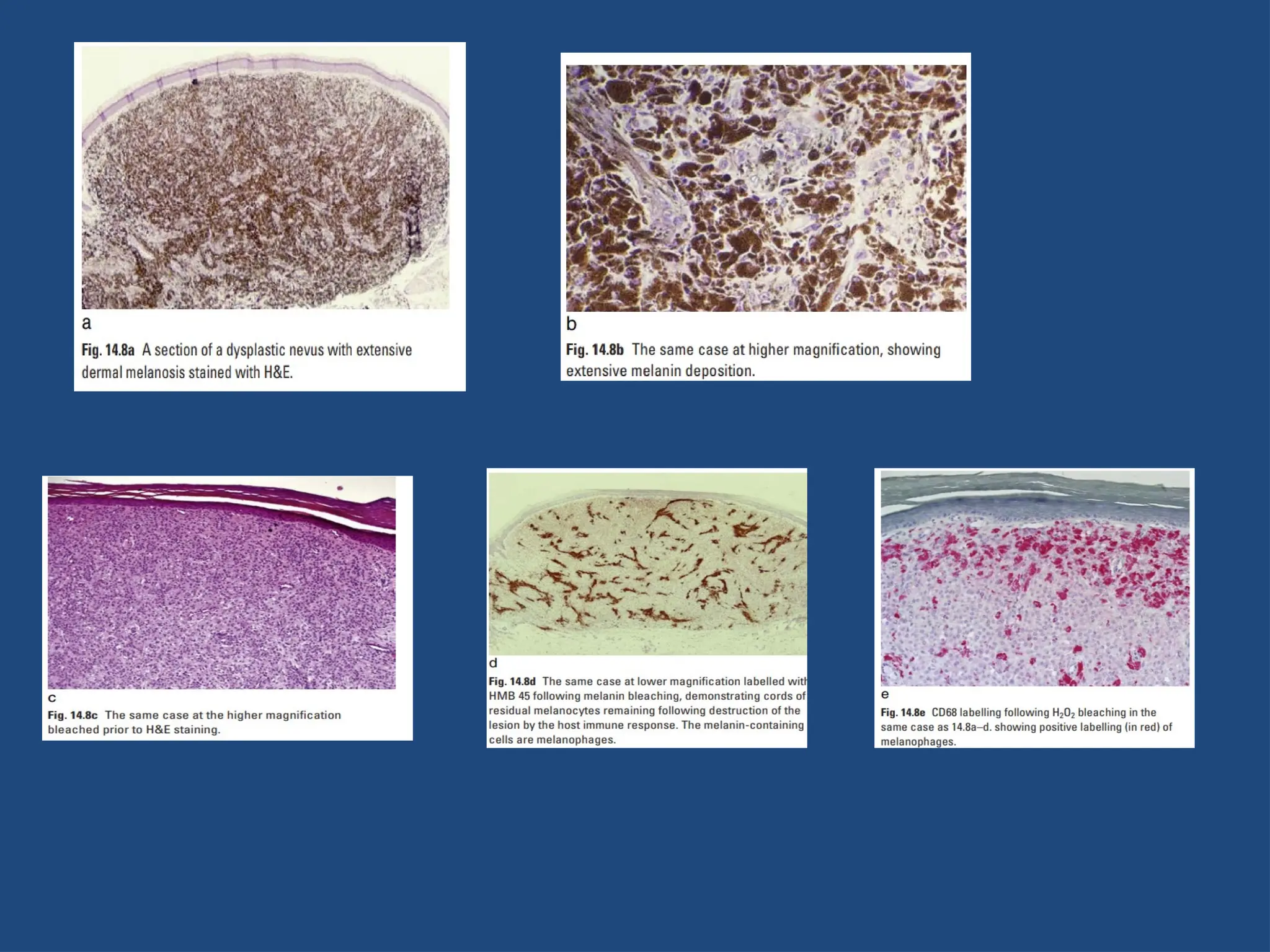 pigment and its stain in histopathology.pptx